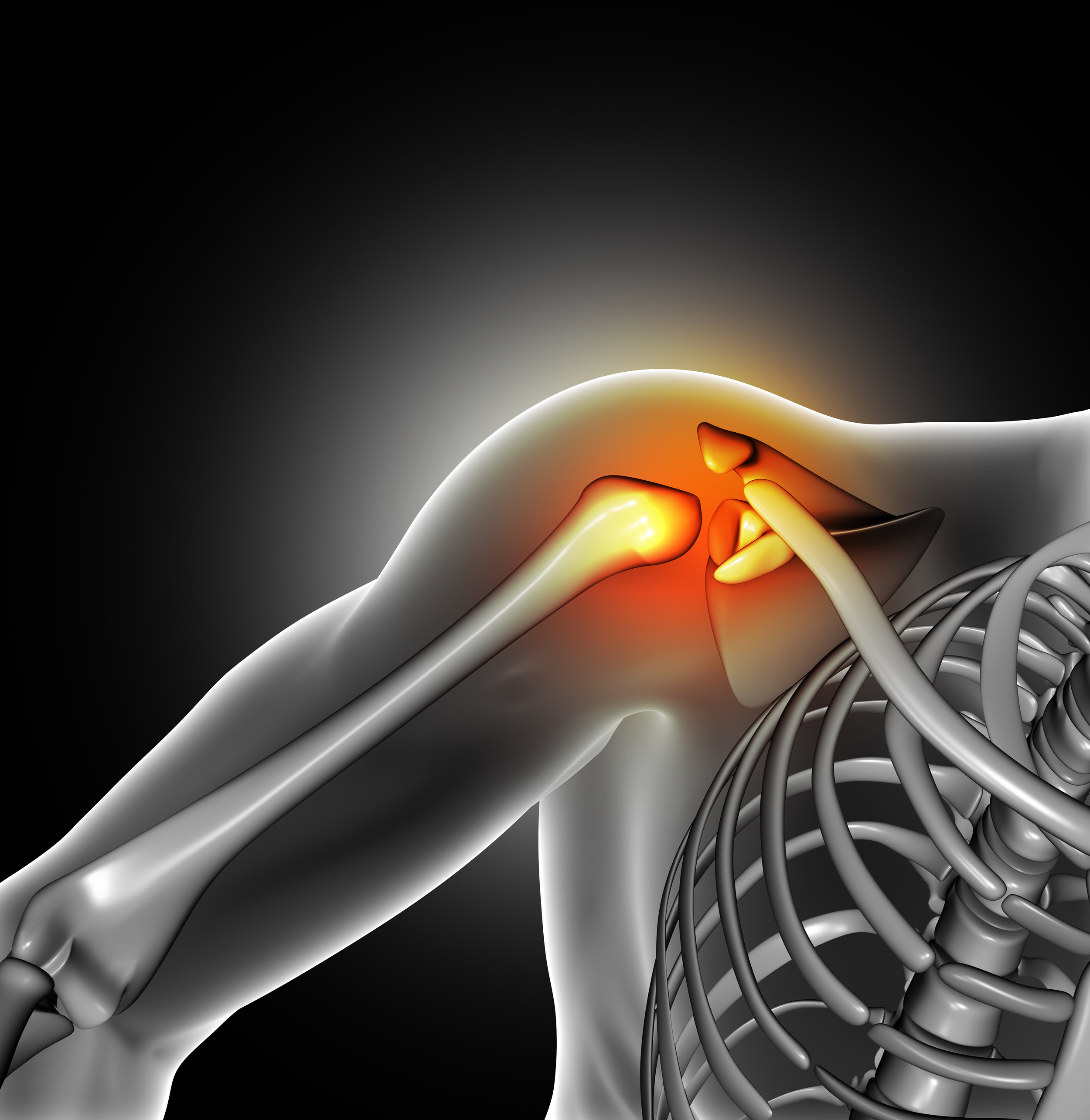 Shoulder Strain — Agape Health & Fitness