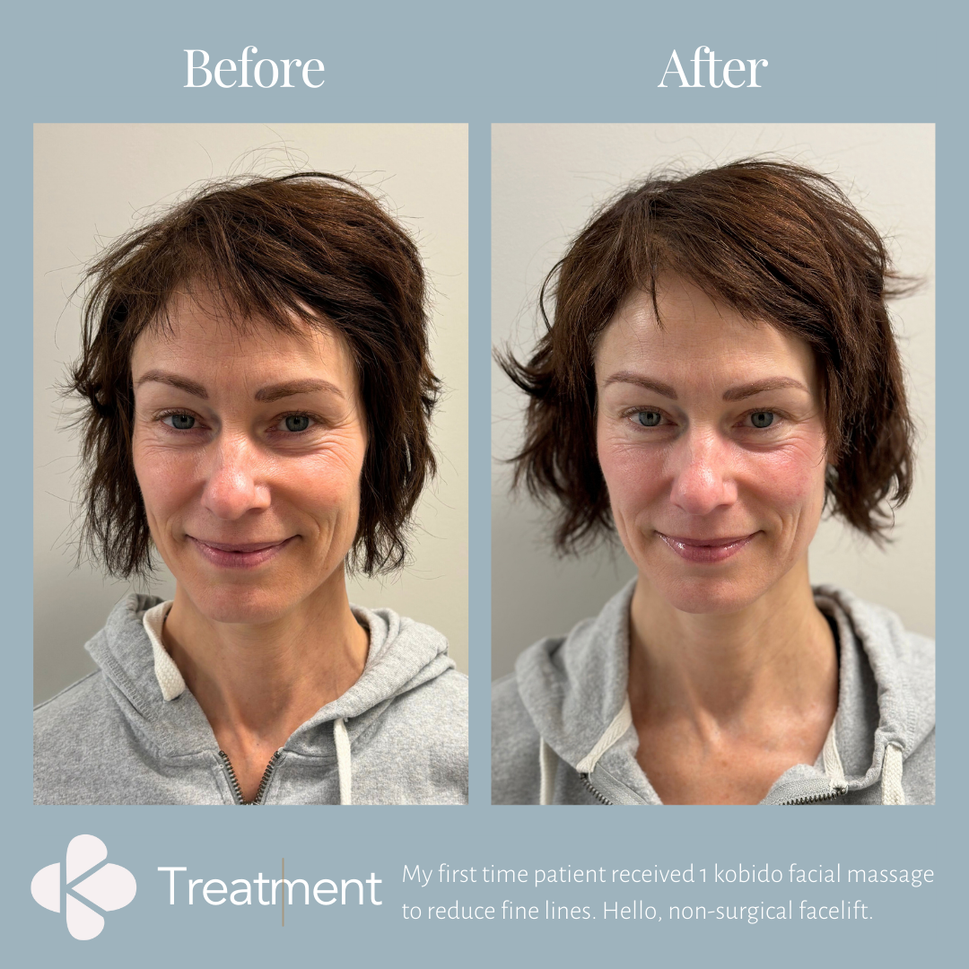 Integrative Skincare And Kobido Facial Massage Radiant Results — Dr Katie