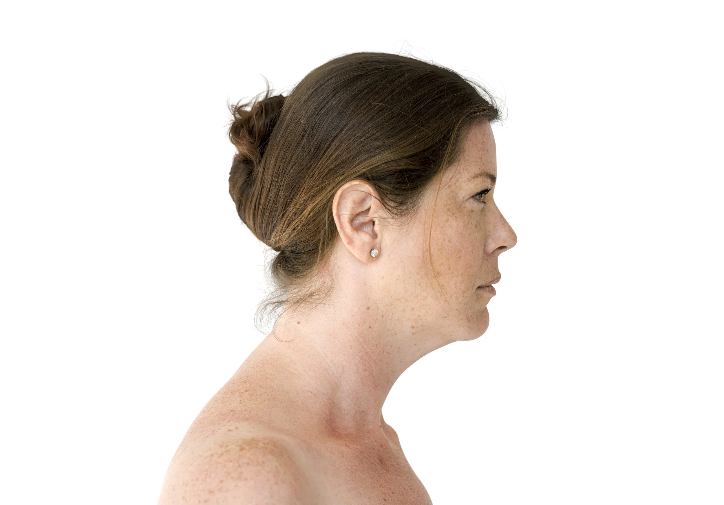 Neck pain, anterior neck posture and mouth breathing — The Body Works ...