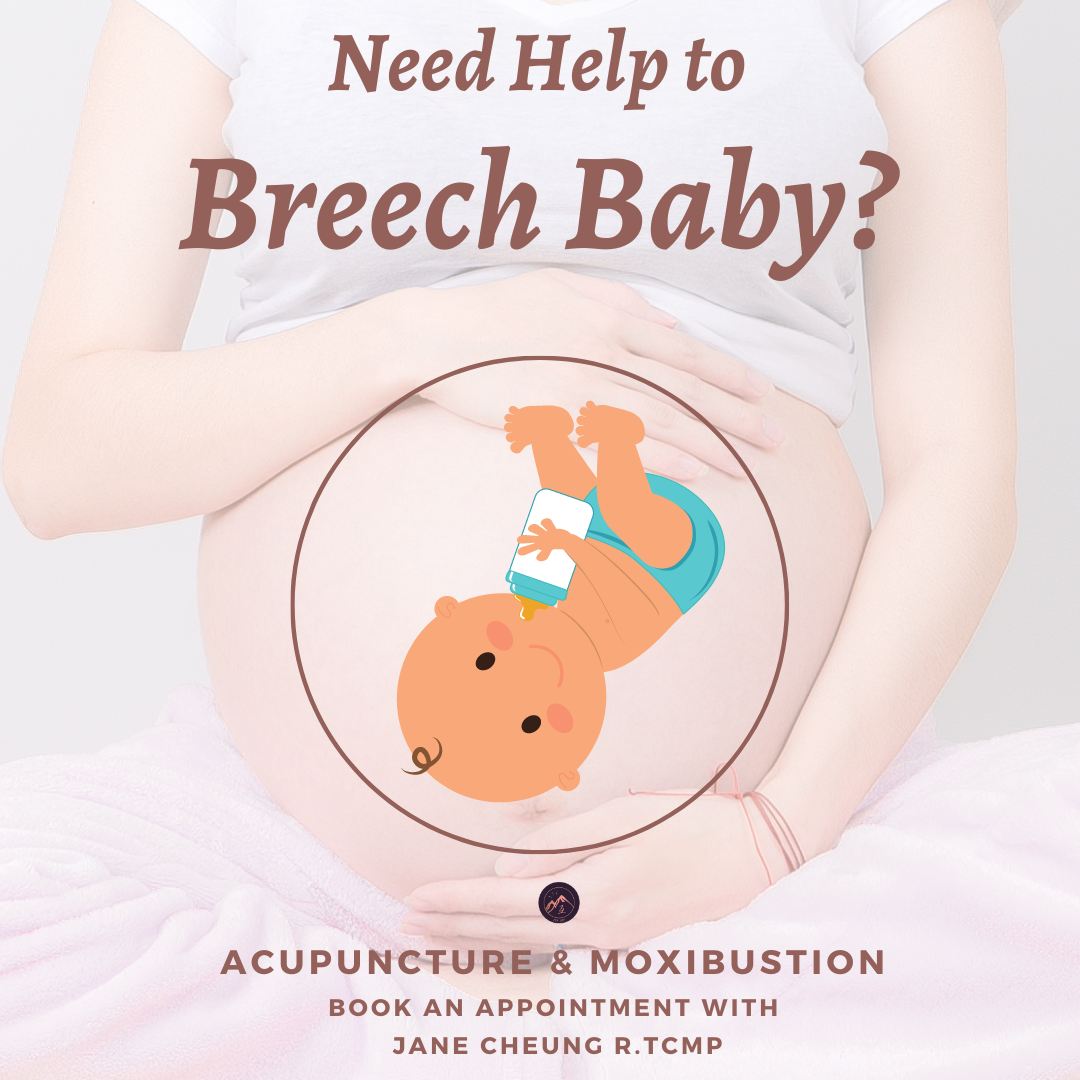 Pregnancy Care - Breech and Posterior Baby — Jane Cheung, R.TCMP ...