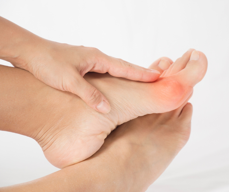 5 Main Types of Foot and Ankle Arthritis — Goldsmith Podiatry