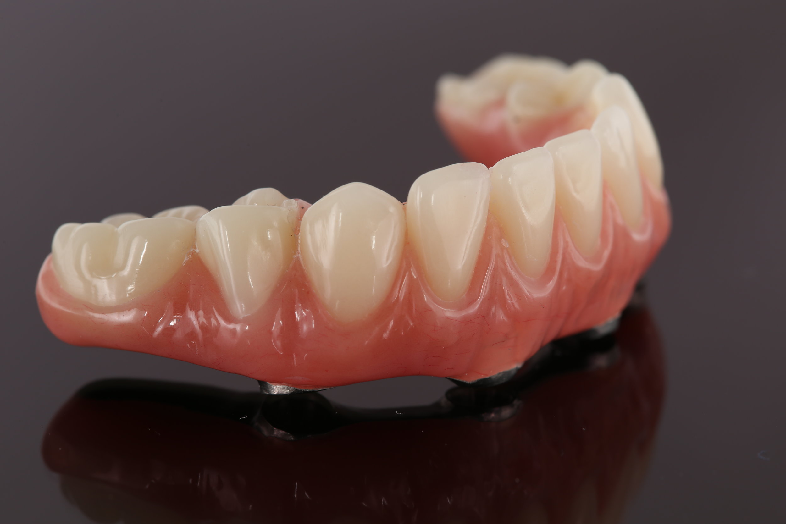 All on 4/ Hybrid Prosthesis — Advanced Dental Implant Solutions