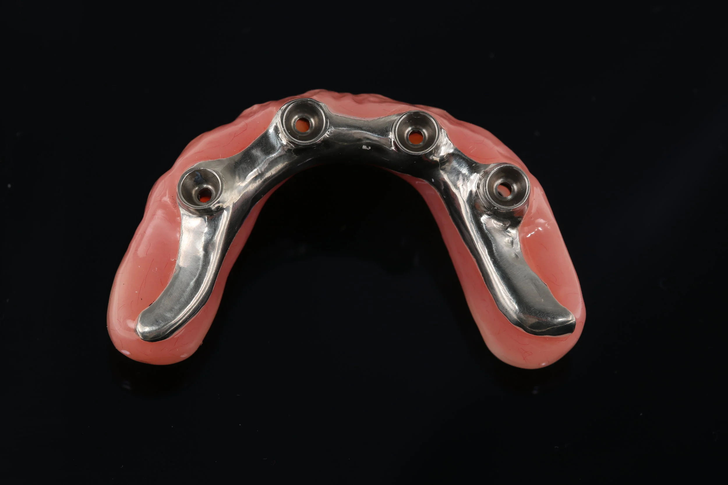 All on 4/ Hybrid Prosthesis — Advanced Dental Implant Solutions