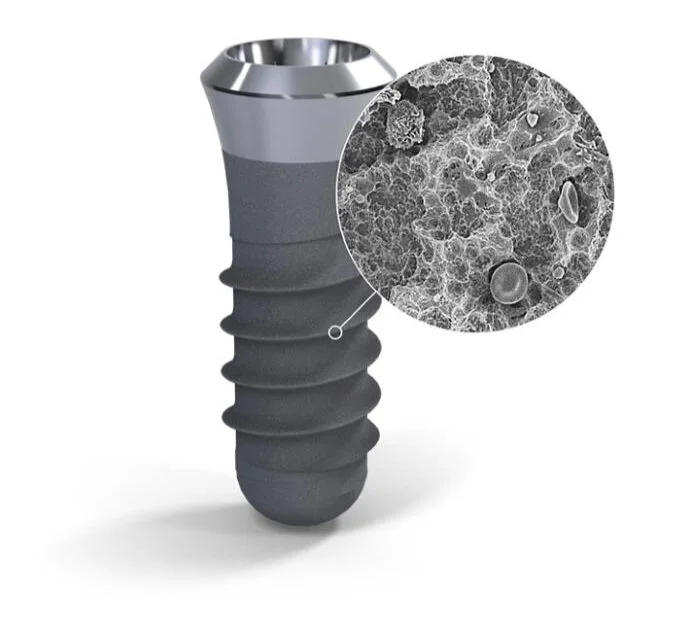 Импланты STRAUMANN - отзывы пациентов и эффективность