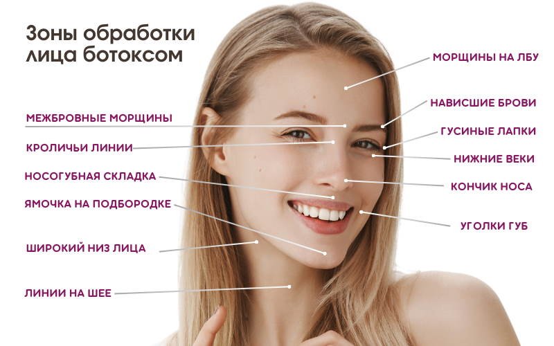 Ботокс (Botox) для лица - всё о препарате и процедуре
