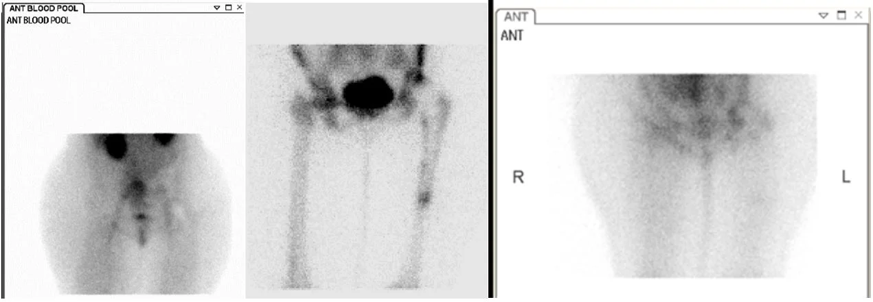CASE 8 — Musculoskeletal Radiology For Post Graduate Doctors