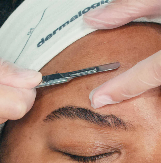 Dermaplane Treatment in Rochester, NY