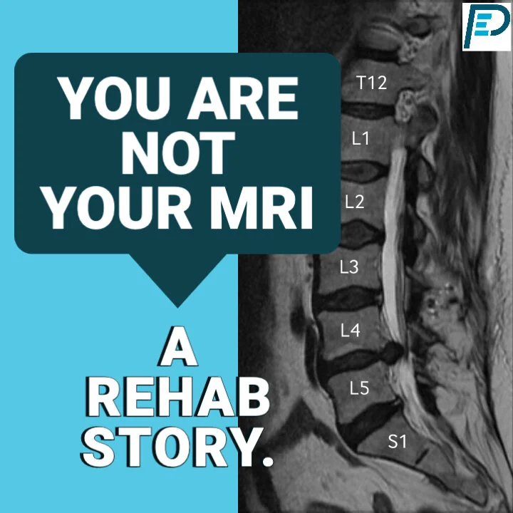 You are not your MRI - A Rehab Story — Physio Effect Glasgow