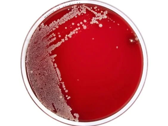 Orb - Real Time Biomonitoring