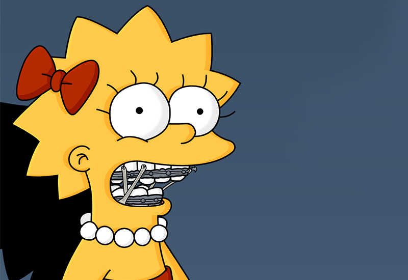 Halloween Costume Ideas with Braces | Beecroft Orthodontics — Top ...