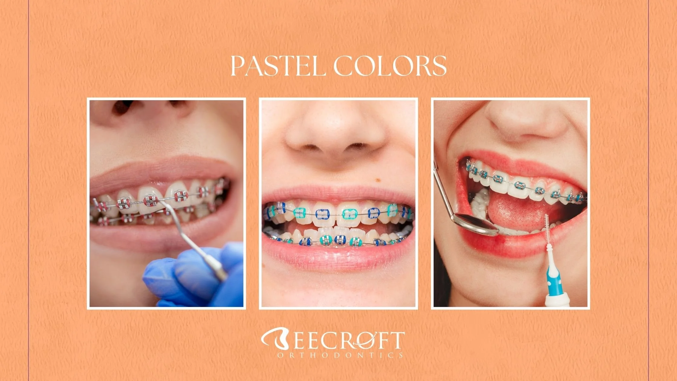 Blog — Beecroft Orthodontics
