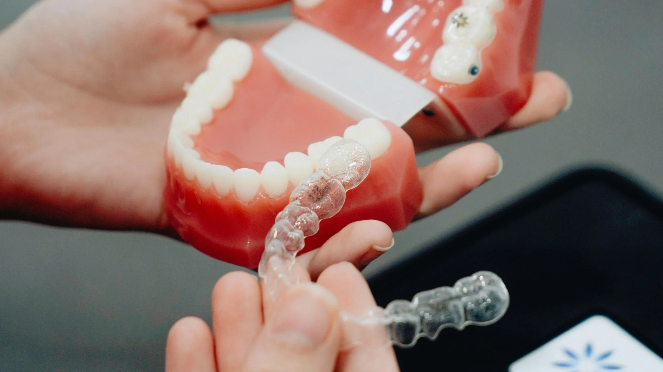 The Role of Retainers in Maintaining Your Smile — Top Orthodontist in ...