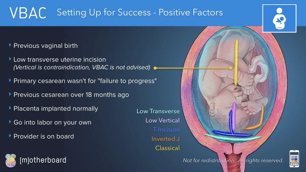 Preparing for a VBAC: 7 Helpful Tips (2022) — Motherboard Birth