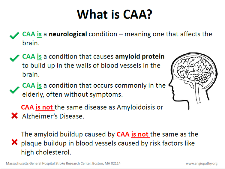 What is CAA? — Cerebral Amyloid Angiopathy