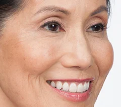 Cosmetic Fillers for Lips and Face | Med Spa Raleigh, NC — LORENA LUCA