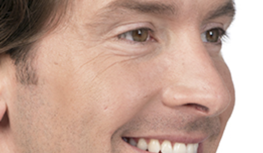 Cosmetic Fillers for Lips and Face | Med Spa Raleigh, NC — LORENA LUCA