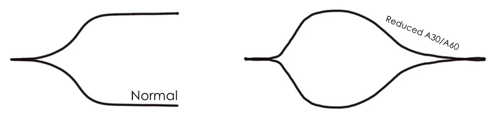 Viscoelastic Assays — HaemBase