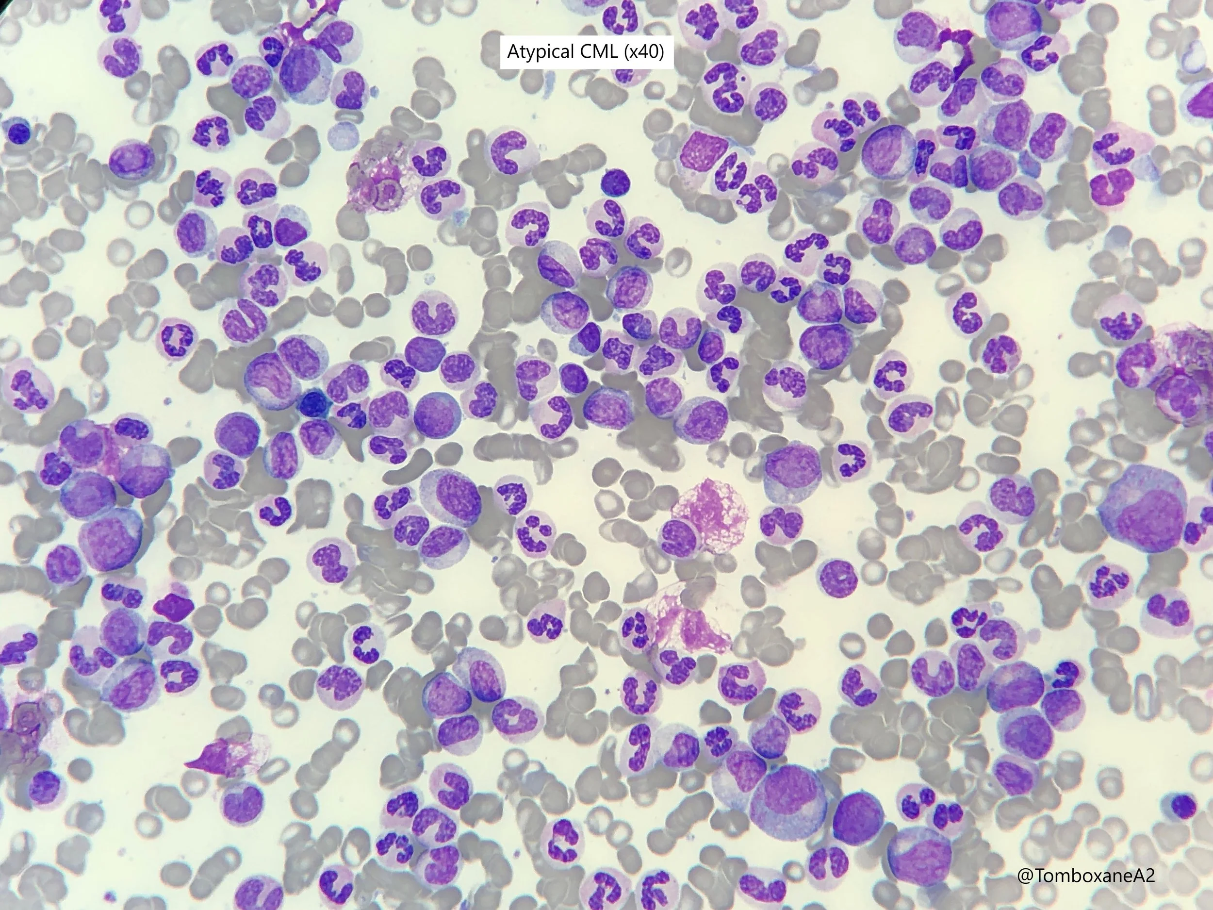 Aspirate — HaemBase