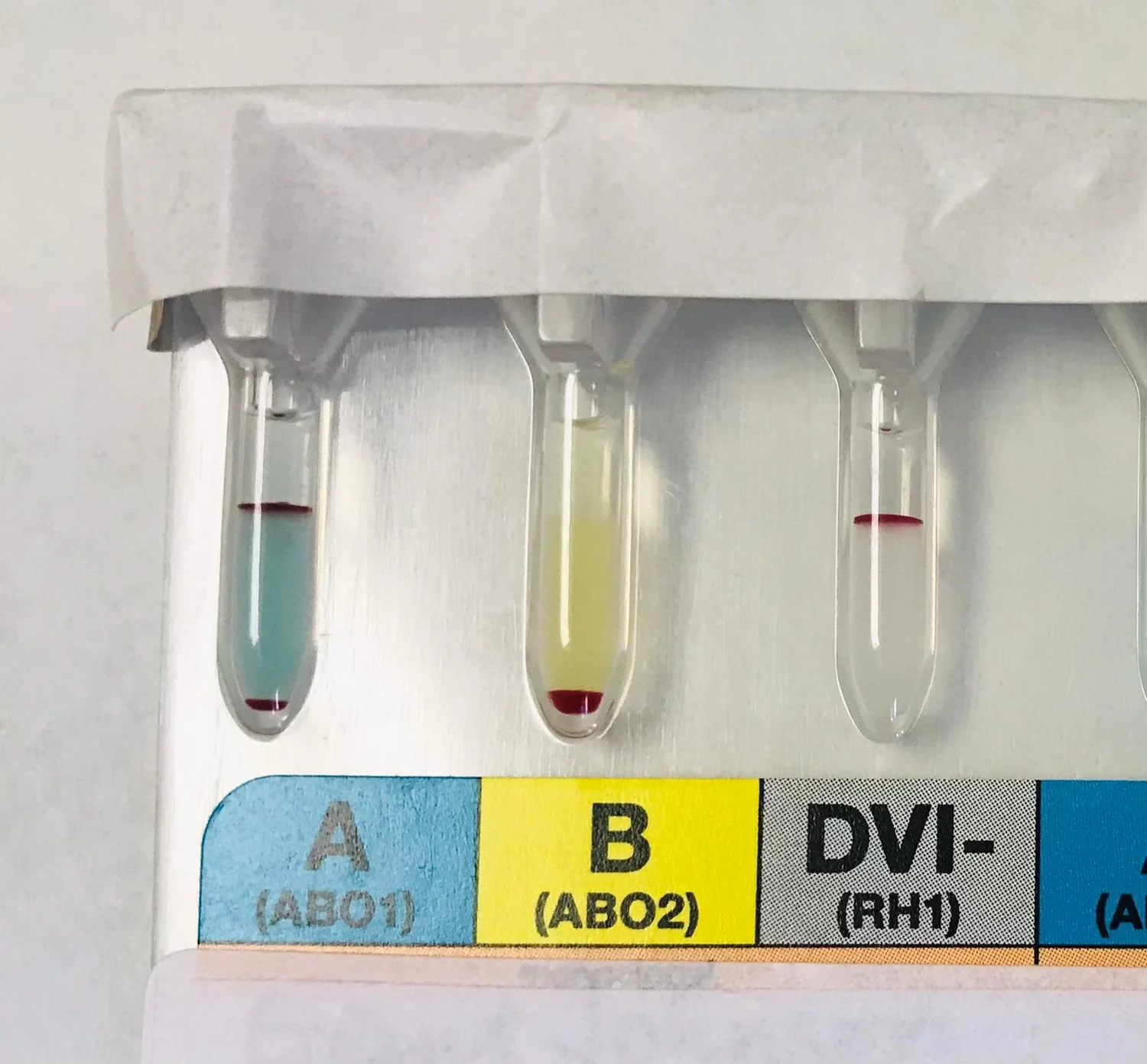 Pre-Transfuion Compatibility — HaemBase
