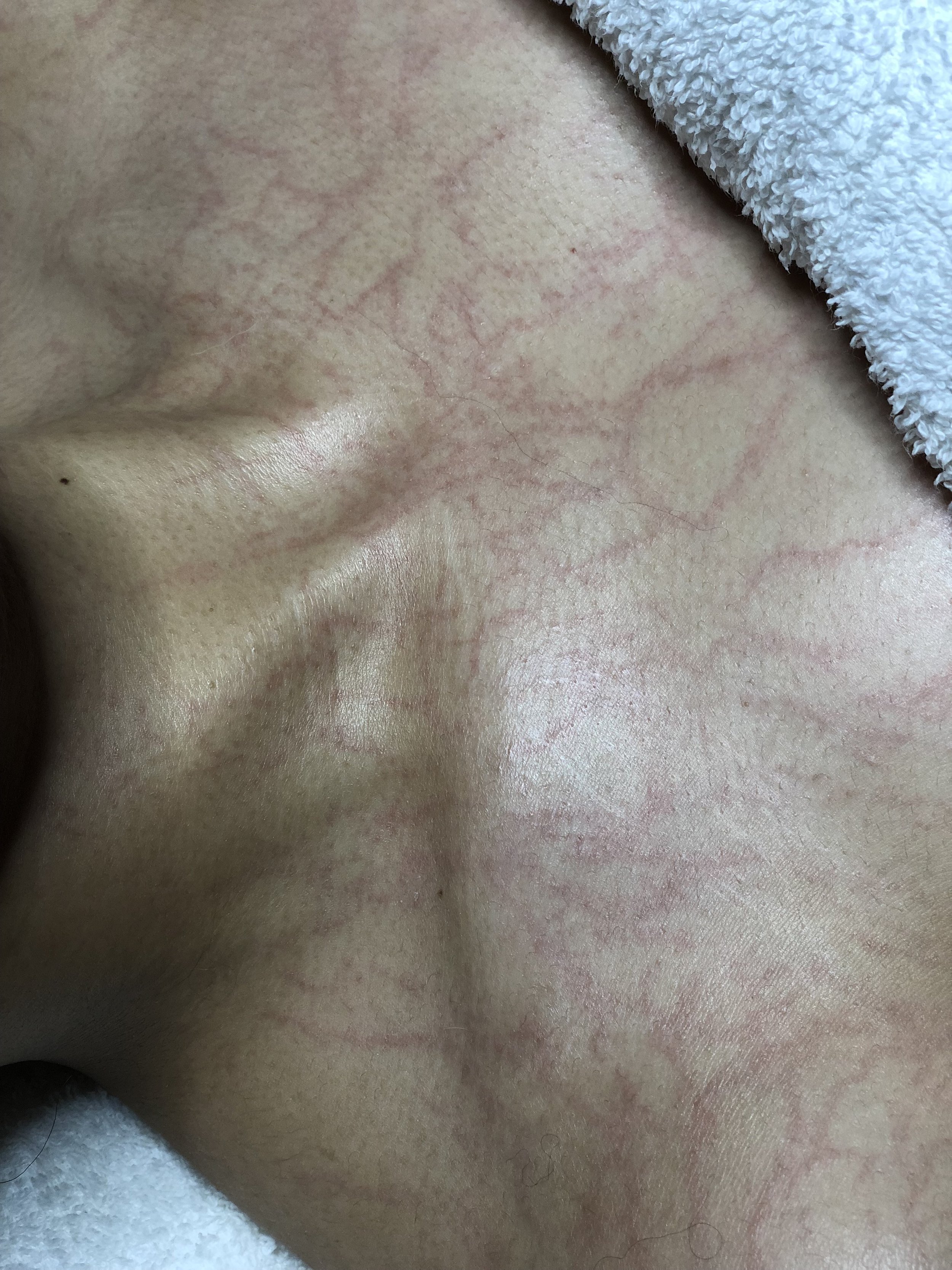 Dmk Enzyme Therapy — With Grace Skin Management