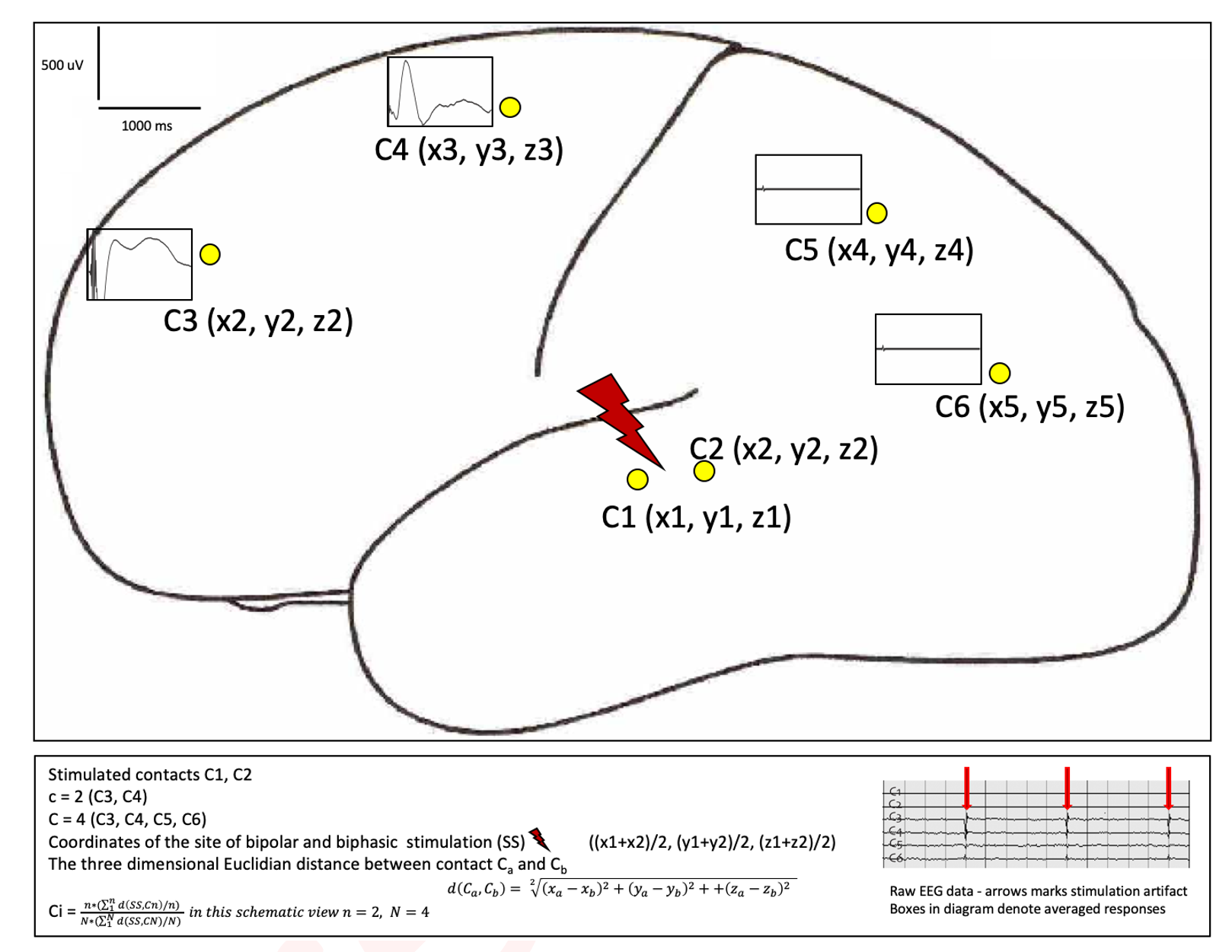 In a pursuit of effective methods for reliable localization of the epileptic network: The ...