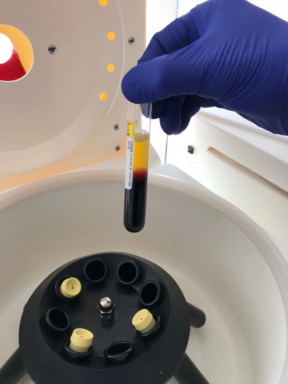 Stem Cell Therapy - Boulder, Colorado | Boulder Biologics | Jason ...