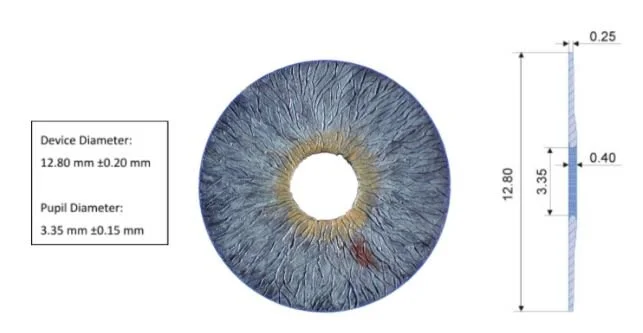 CUSTOMFLEX® ARTIFICIALIRIS — VEO Ophthalmics