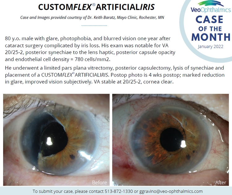 VEO Ophthalmics
