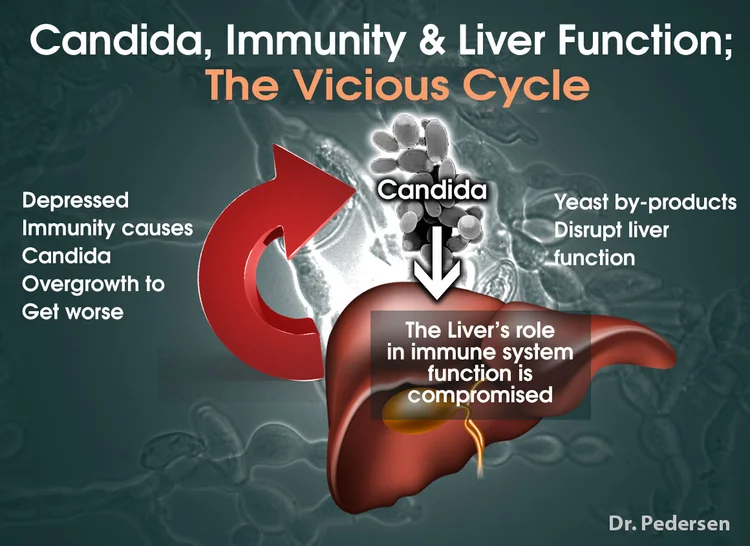 Alkaline Structured Silver: The Shiny New Way to Beat Yeast Infections ...