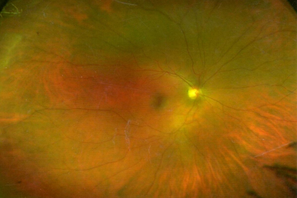 Optometry — Eye Priority