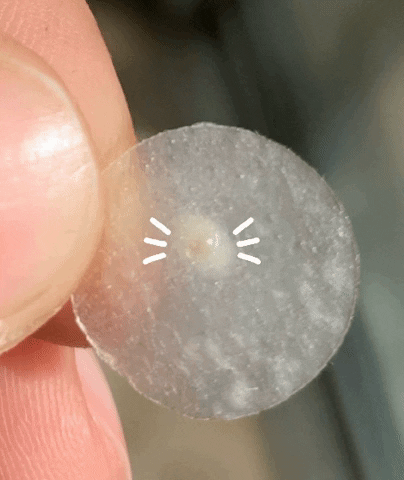 [REVIEW] By Wishtrend Clear Skin Shield Patch (Before and After ...