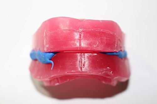 Full and Partial Denture Auckland Sandringham — Clinical Smiles Denture ...