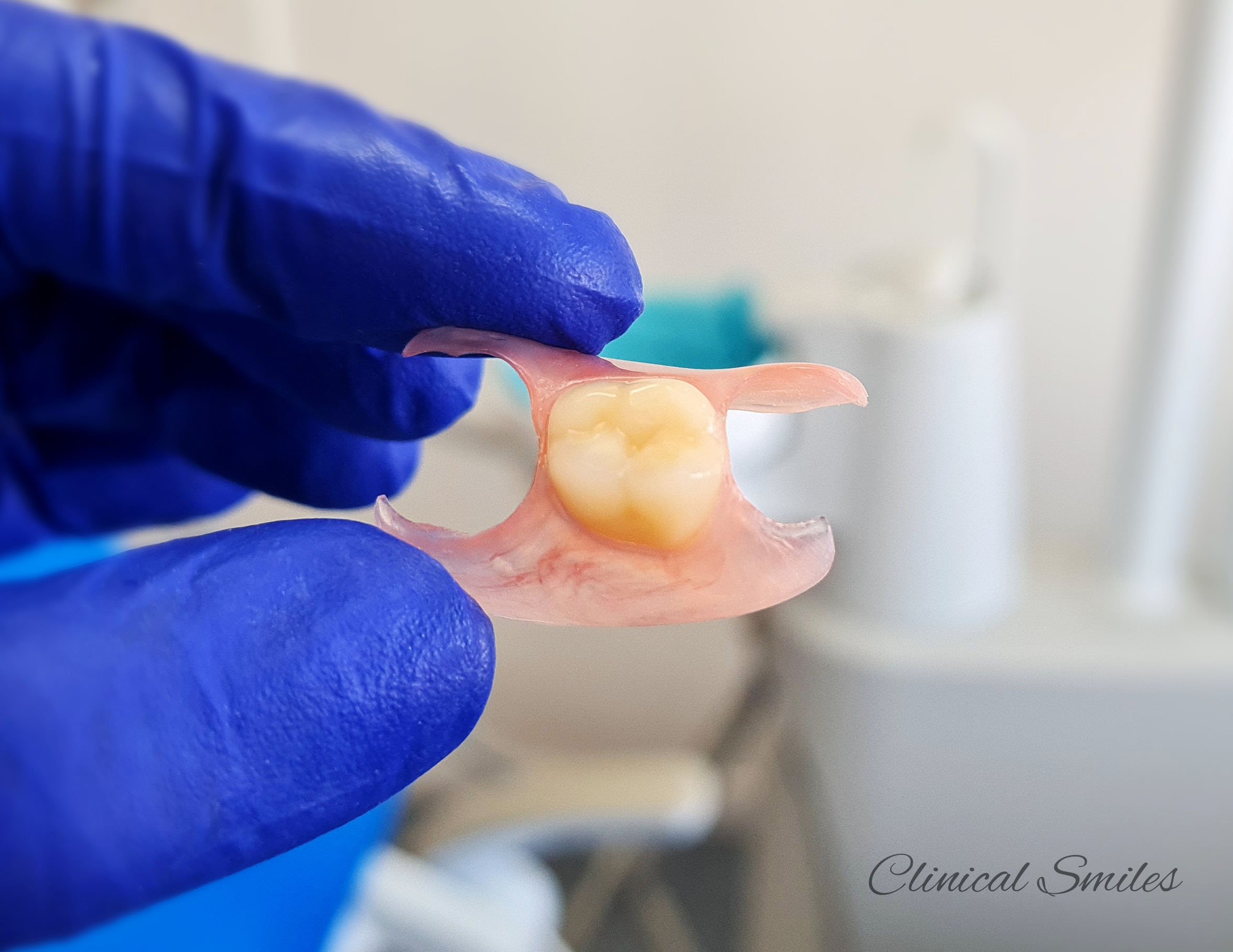 Flexible Valplast Dentures Auckland — Clinical Smiles Denture Clinic