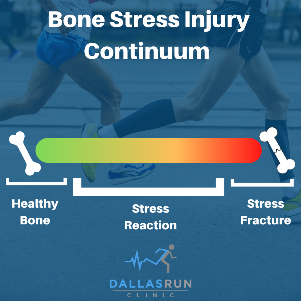 Bone Stress Injury Risk Factors – ITVQ