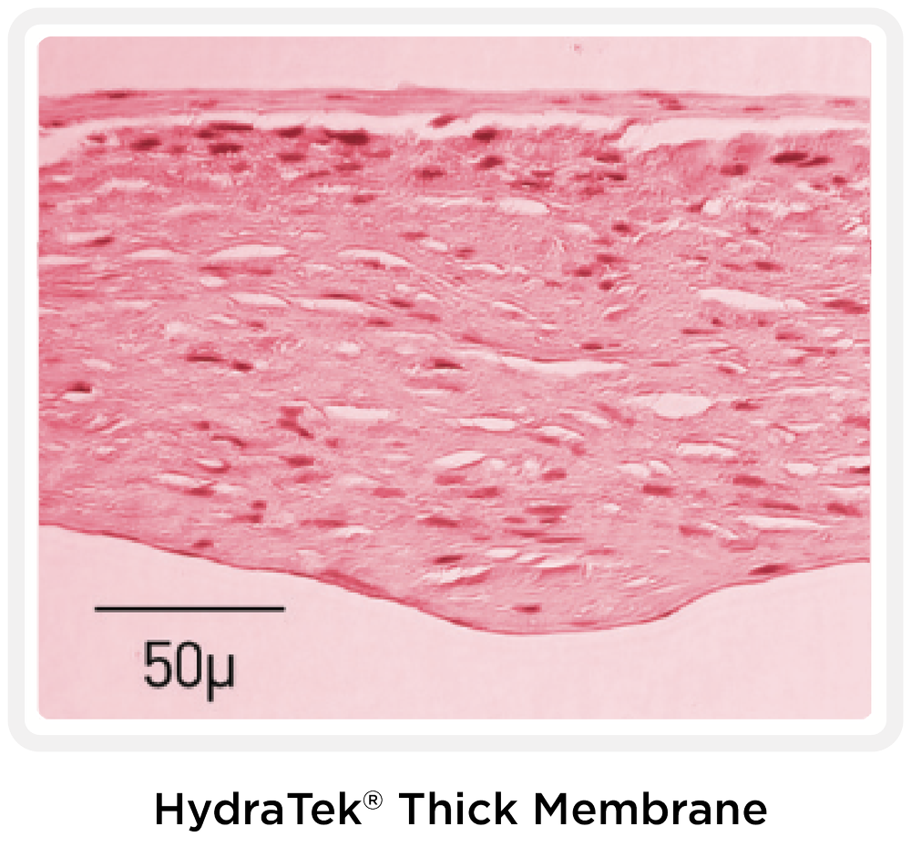 Overview — HRT