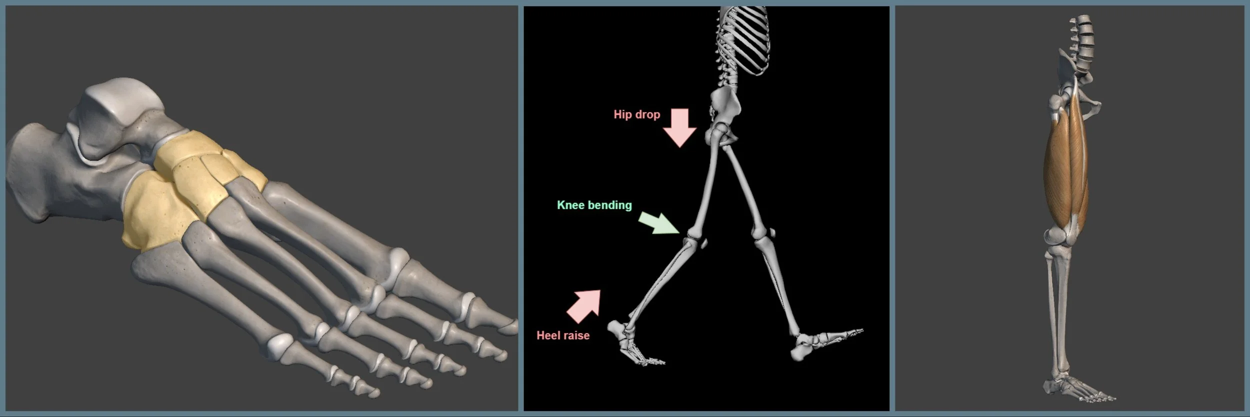 THE MOVING BODY - Walking Gait Analysis (Part II): Gait goals and ...