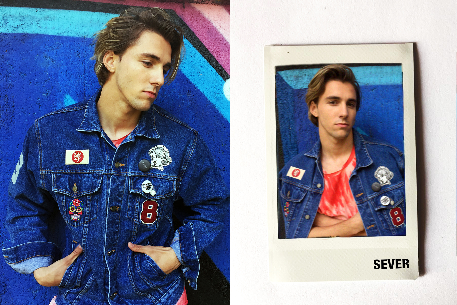 HISTORY — Robert Sever