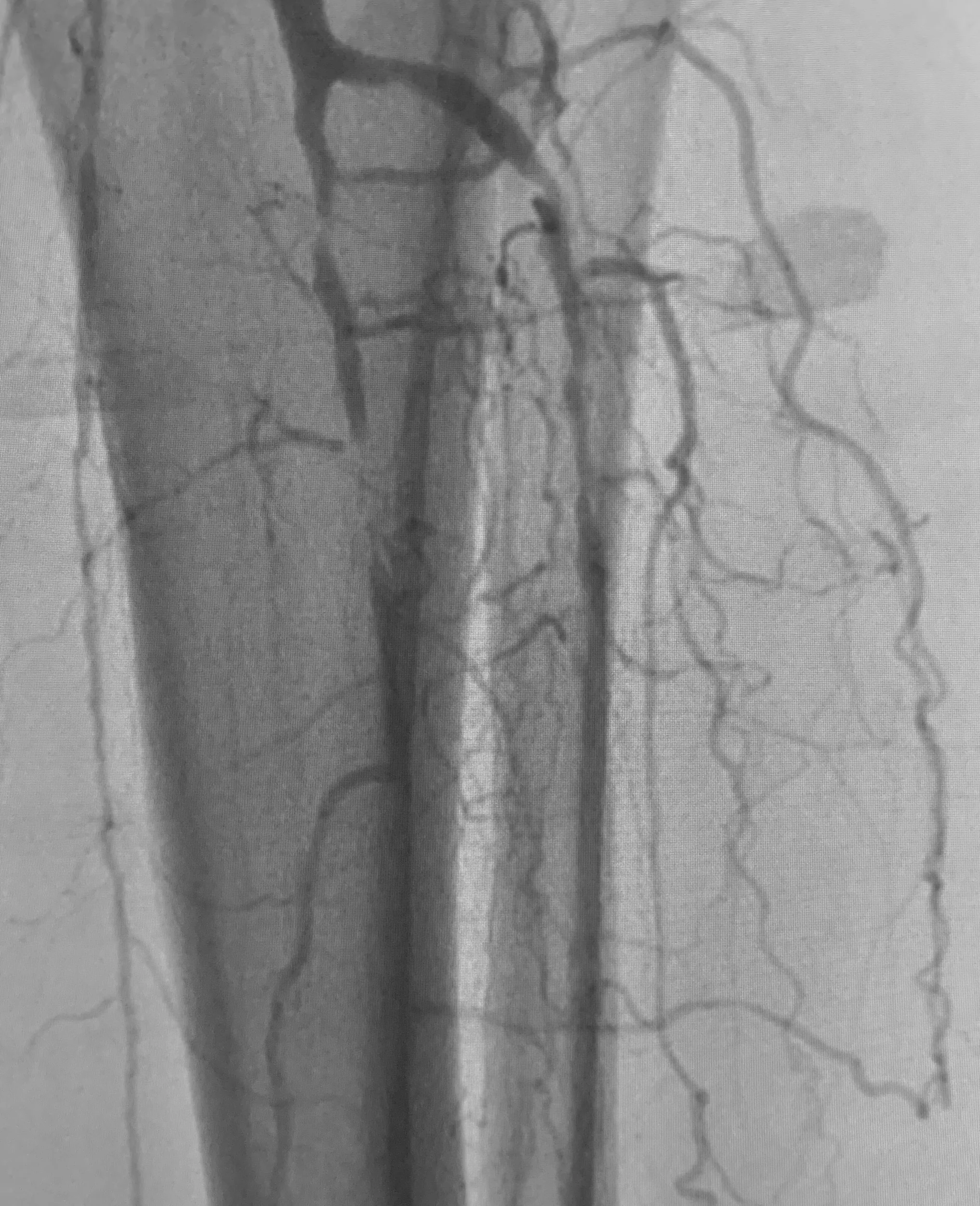 Harrison Heart & Vein