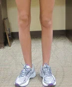 Postural Restoration Institute (PRI) — Pinnacle Physical Therapy