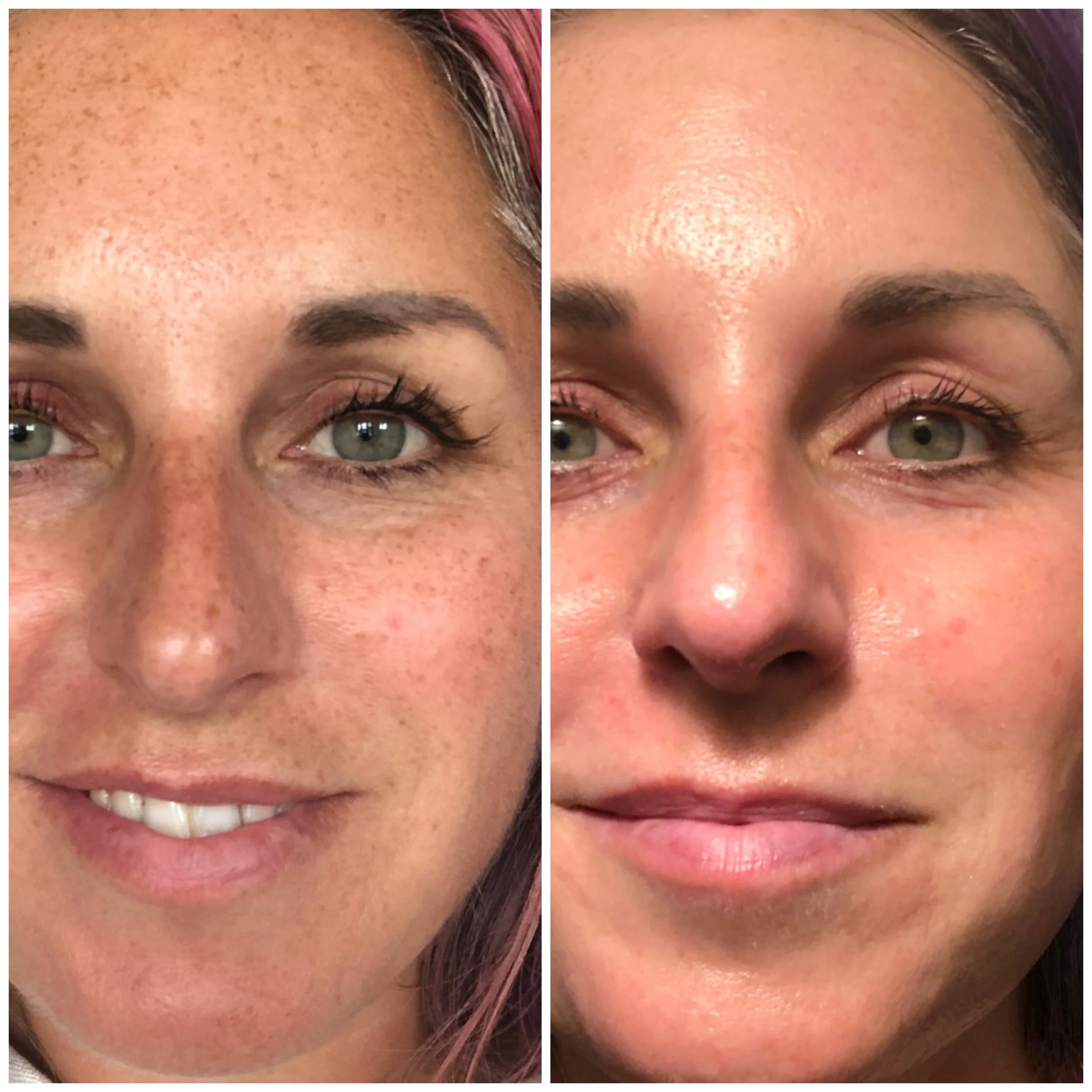 How To Get Rid of Skin Pigmentation - Winchester | Secret Garden Skin ...