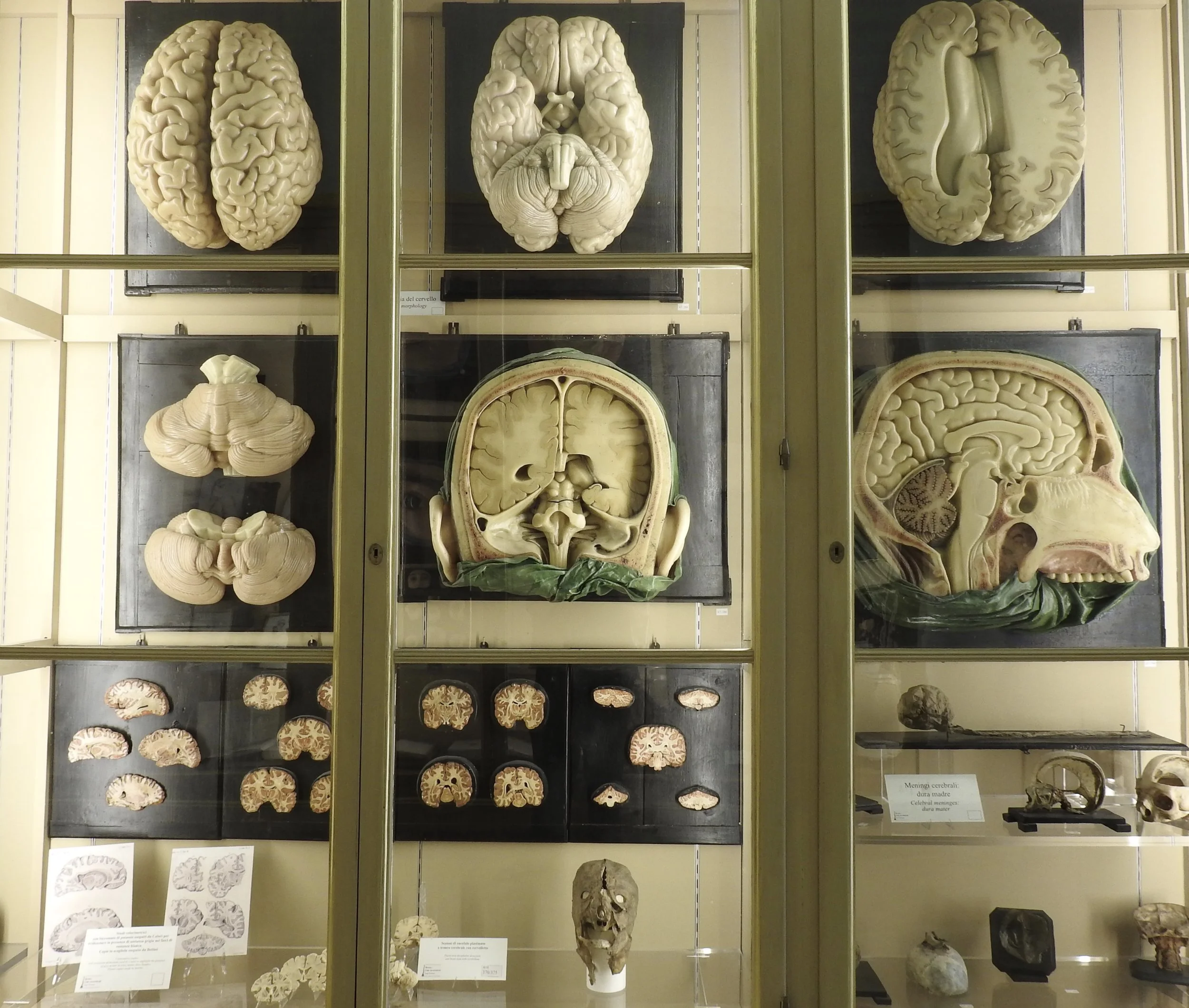 Human anatomical collections of Bologna — Renée DeVoe Mertz