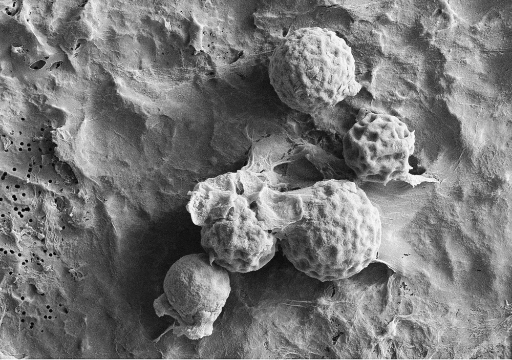 Fighting The Fungus Of Valley Fever — Methods