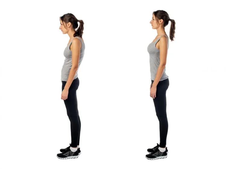 How to Fix Rounded Shoulders — Laguna Orthopedic Rehabilitation