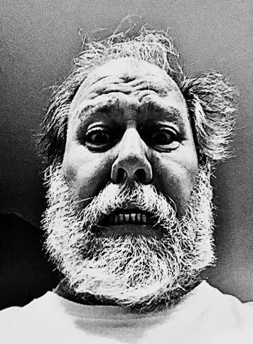 In the Face of Anger - A Story of Acceptance and Recovery — Human Amplified