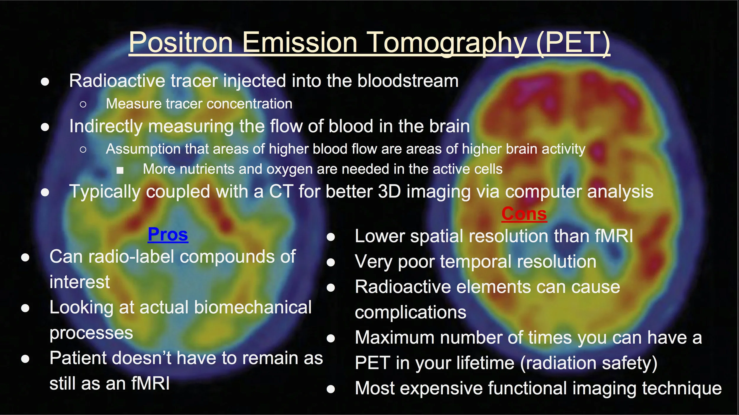 Functional Neuroimaging Techniques — Institute of Neuro Innovation