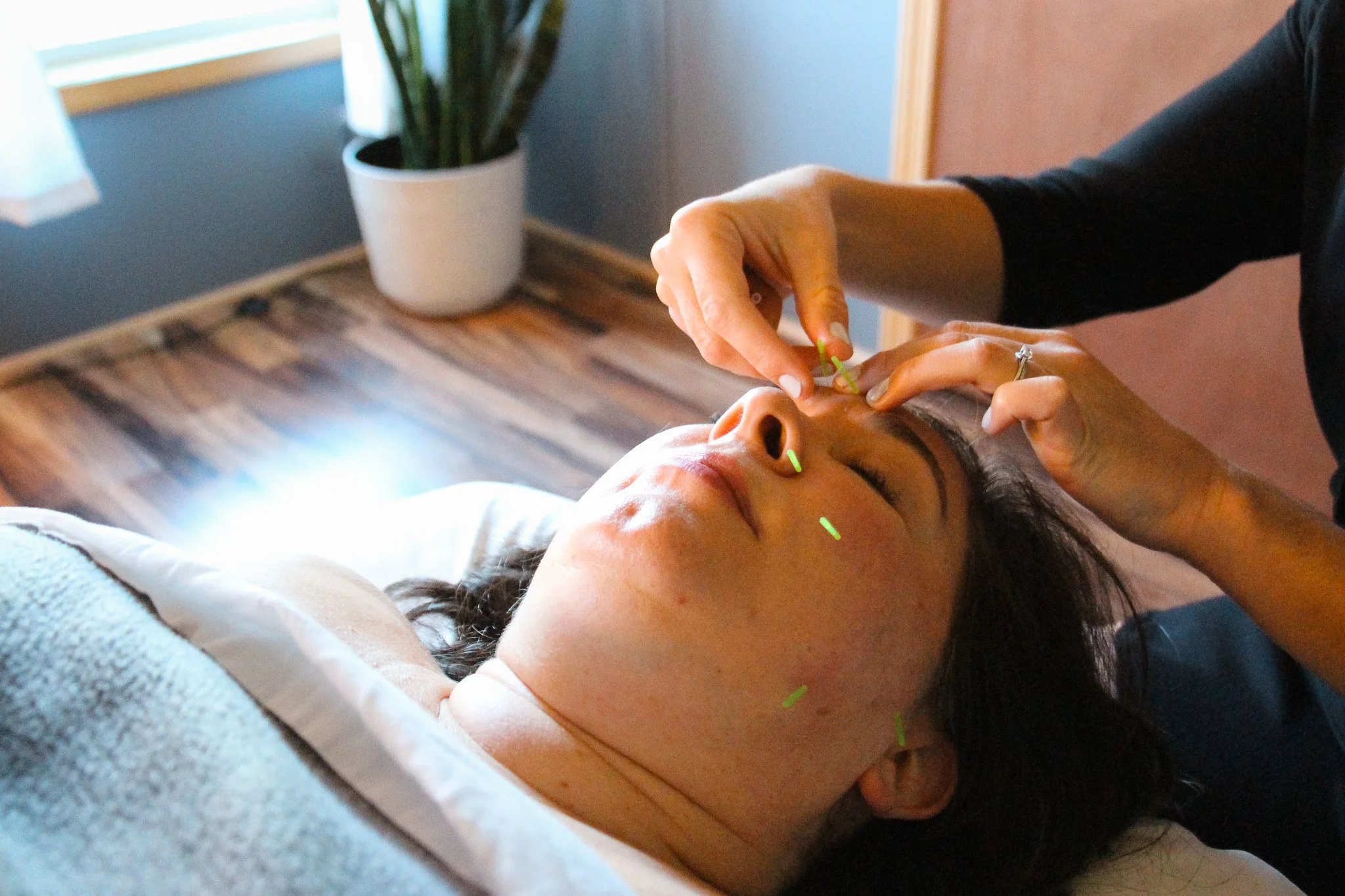 Acupuncture — Home