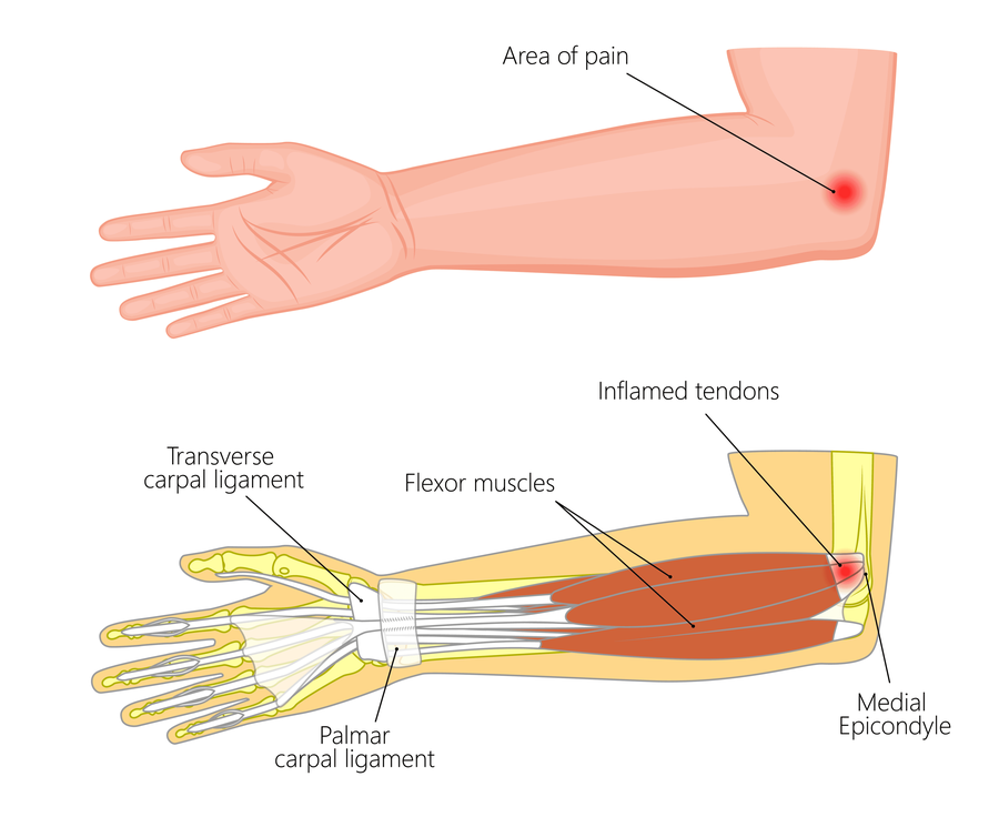 Elbow Injuries and Conditions | Aptiva Health