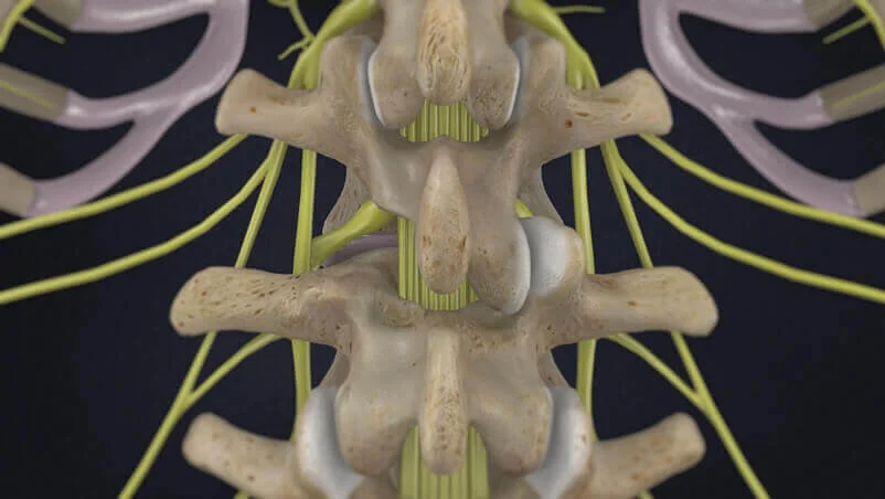 Lumbar Decompression | Aptiva Health