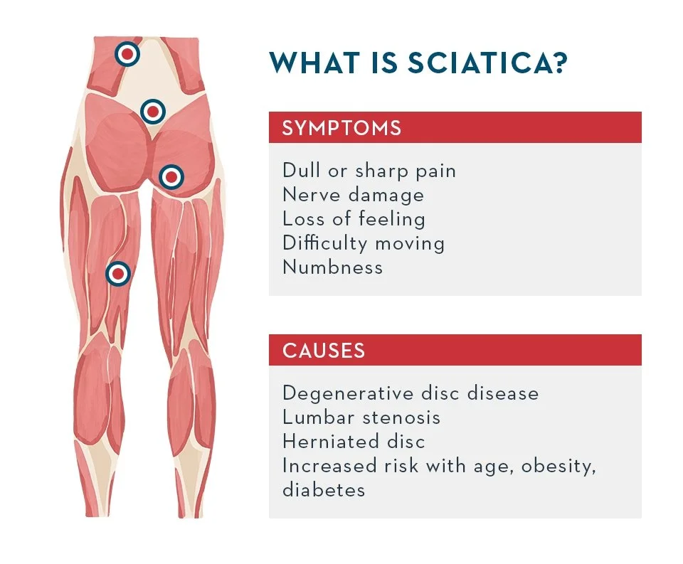 Sciatica Treatment: Find Pain Relief | Aptiva Health