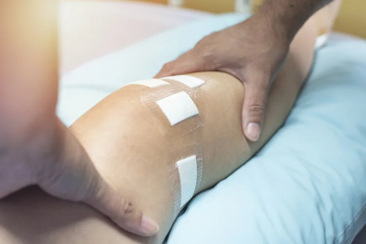 ACL Repair | Aptiva Health